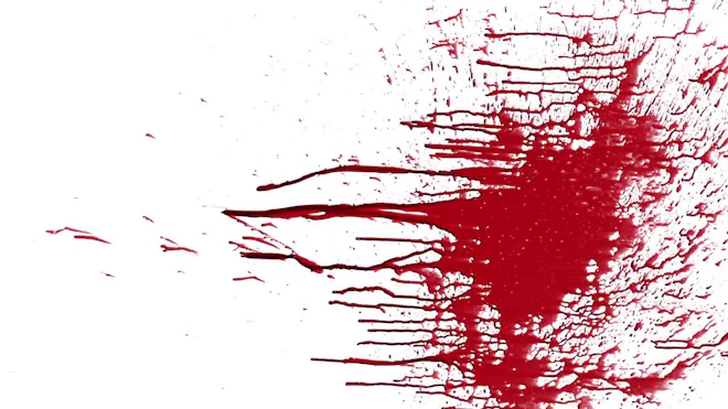Real Blood Splat 2,124 Blood Splatter Stock Photos, High Res Pictures,