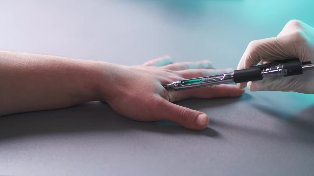 RFID Chip Implantation Process In... - Stock Video | Motion Array