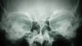 Old Vignette V. 2 - Motion Graphics | Motion Array