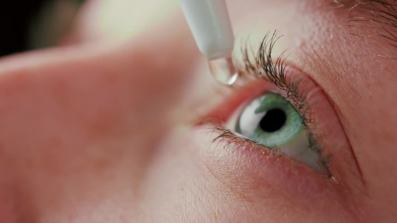 Woman Receiving Eye Drops - Stock Video | Motion Array
