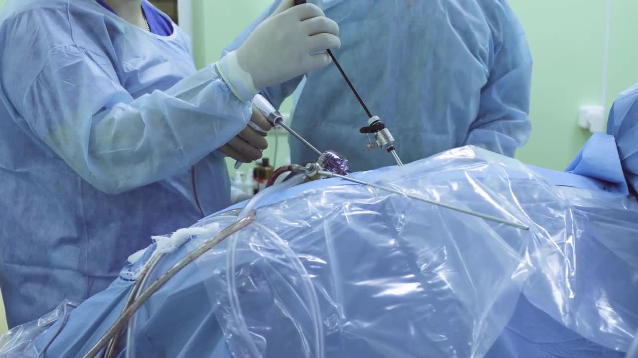 Laparoscopic Surgery - Stock Video | Motion Array