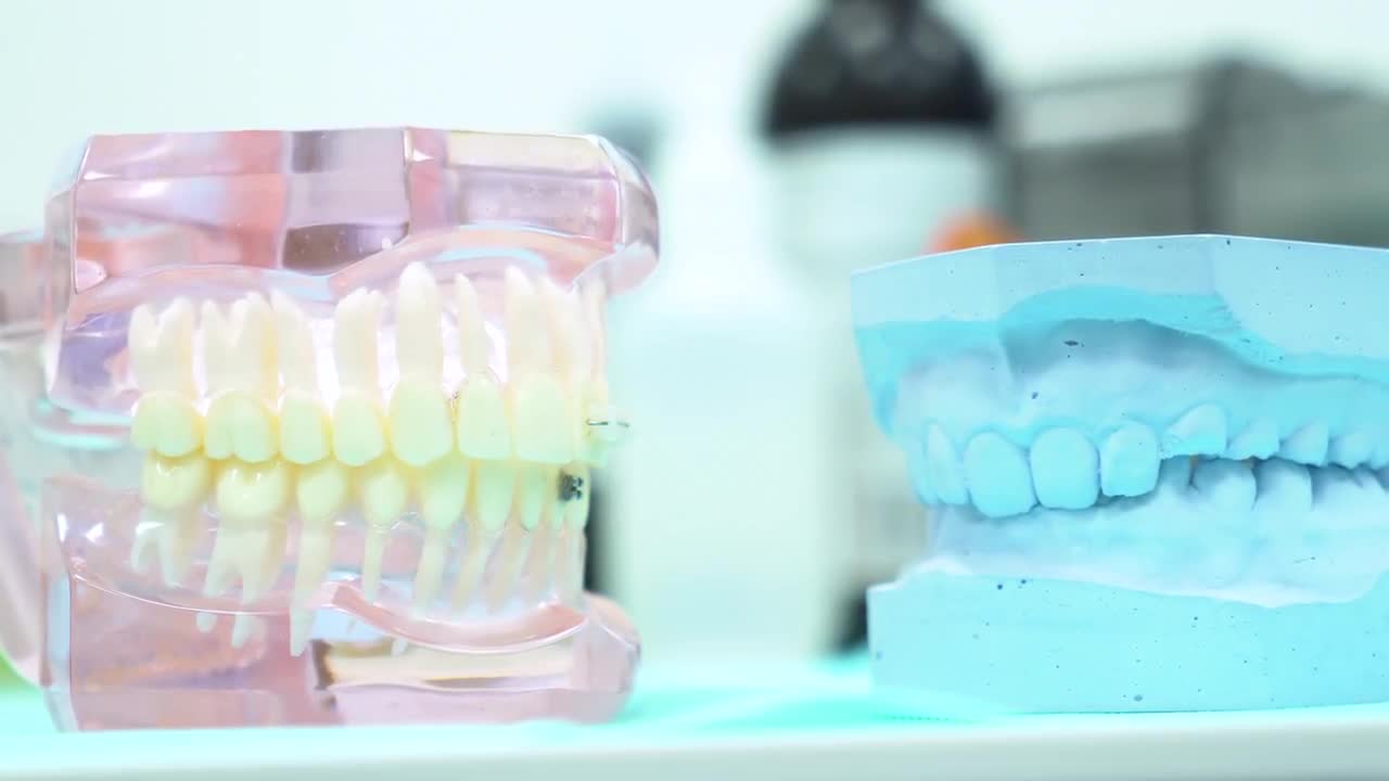 Dental Teeth Model - Stock Video | Motion Array