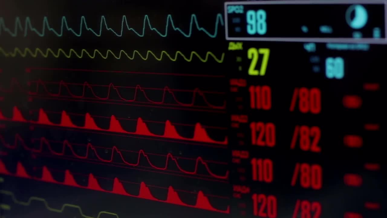 Electrocardiogram Monitor - Stock Video | Motion Array