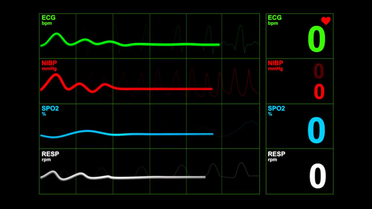 Heart Rate Monitor Going Flat - Stock Motion Graphics | Motion Array